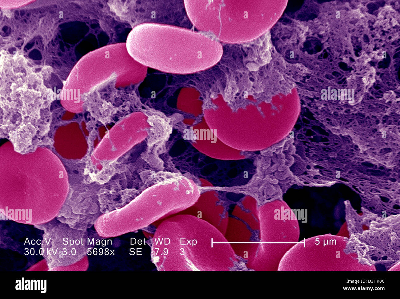 Koagulum fibrin -Fotos und -Bildmaterial in hoher Auflösung – Alamy