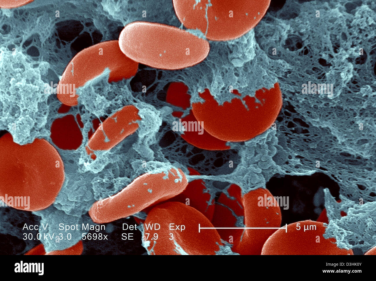 Koagulum fibrin -Fotos und -Bildmaterial in hoher Auflösung – Alamy