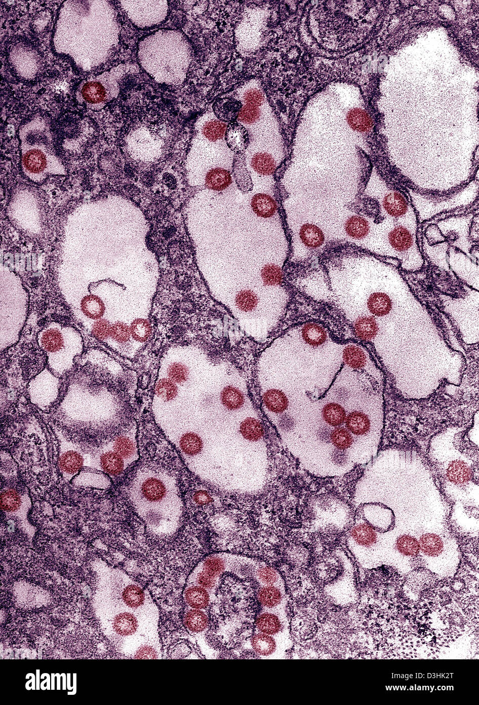 Rift valley fieber virus -Fotos und -Bildmaterial in hoher Auflösung ...