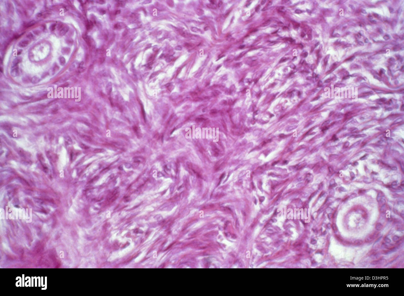 Ovarian follicle histology -Fotos und -Bildmaterial in hoher Auflösung ...