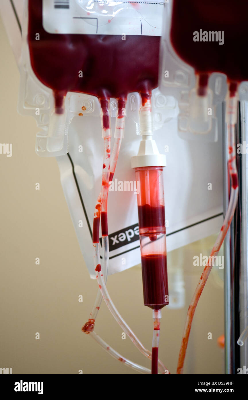 Blood Transfusion Station Stockfotos und -bilder Kaufen - Alamy