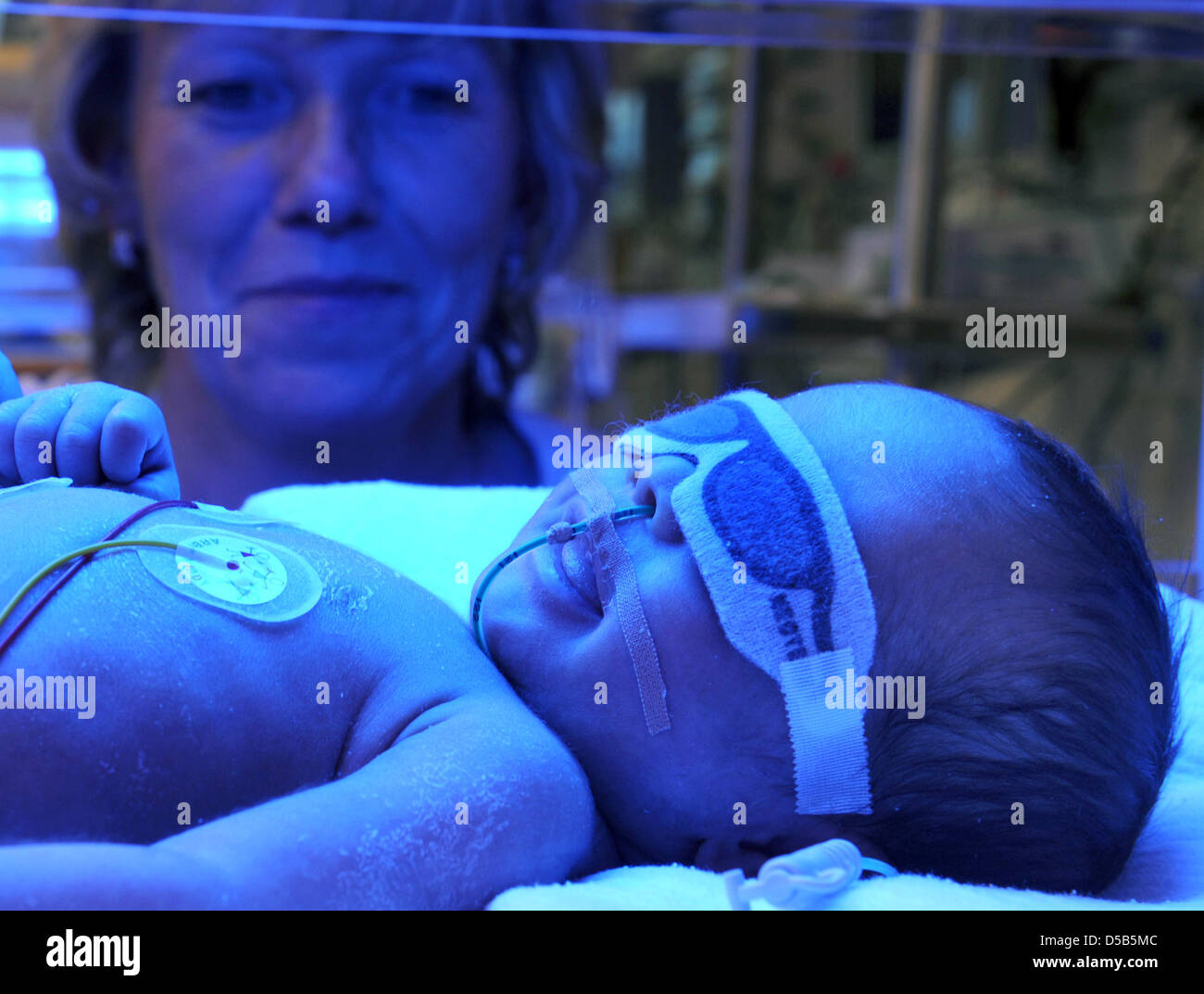 Baby under phototherapy -Fotos und -Bildmaterial in hoher Auflösung – Alamy