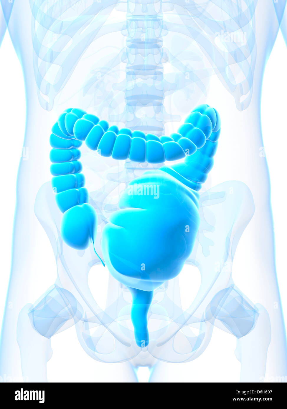 Toxisches megakolon -Fotos und -Bildmaterial in hoher Auflösung – Alamy