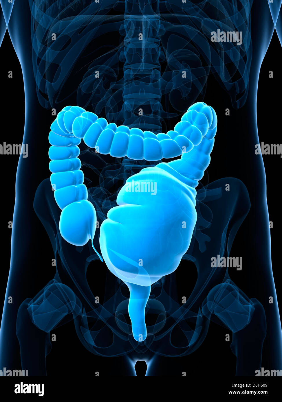 Toxisches megakolon -Fotos und -Bildmaterial in hoher Auflösung – Alamy