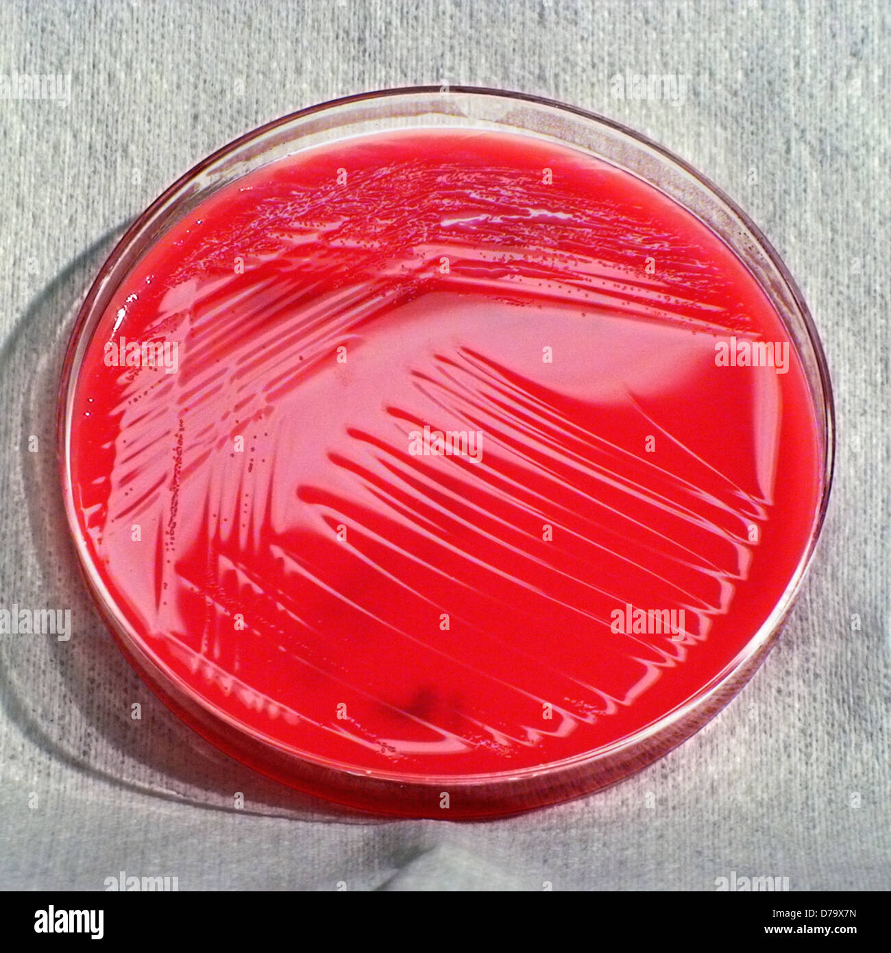Pseudomonas fluorescens -Fotos und -Bildmaterial in hoher Auflösung – Alamy