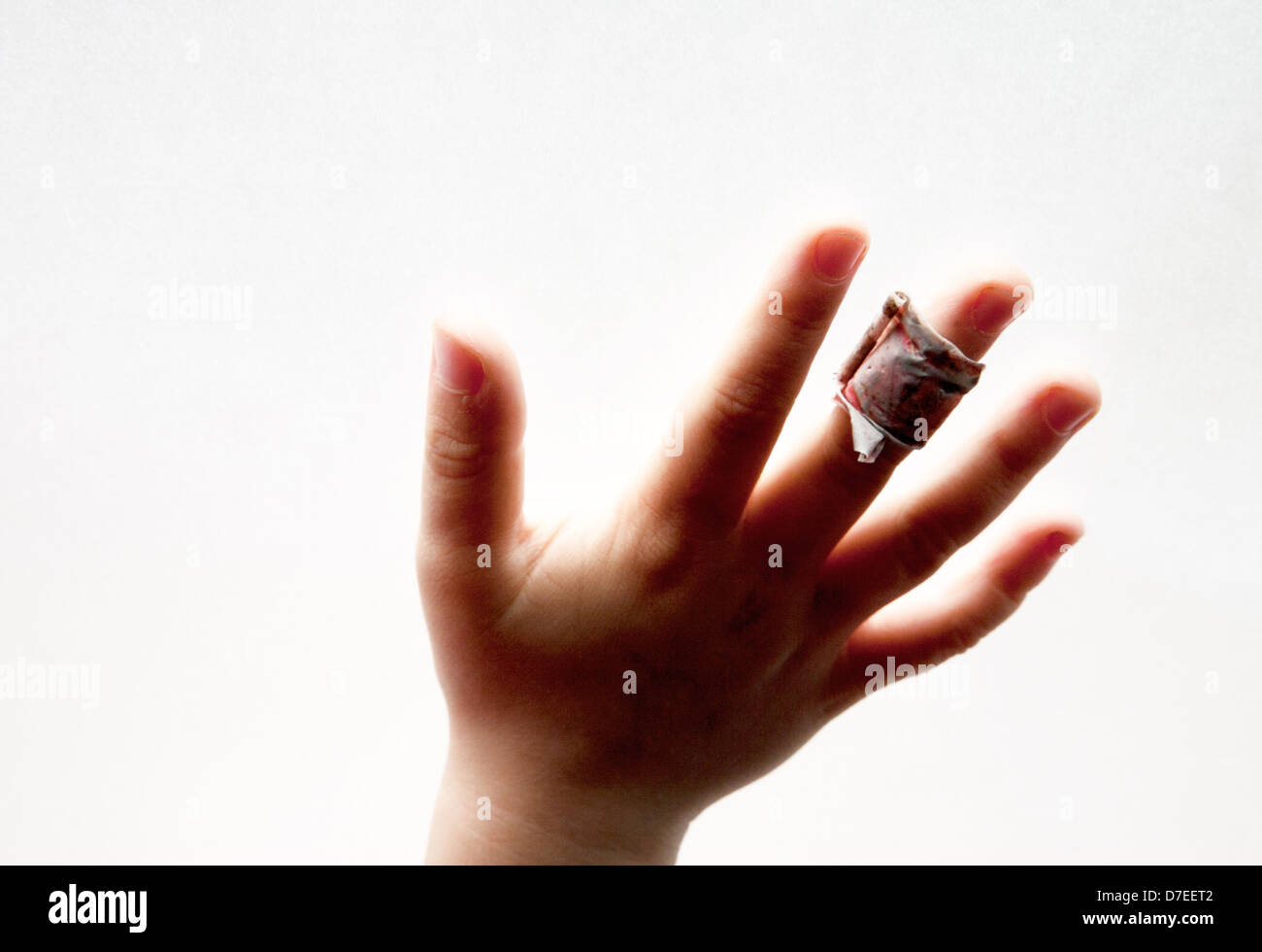 Vier Jahre alter Junge offene Hand mit Gips am Mittelfinger ...