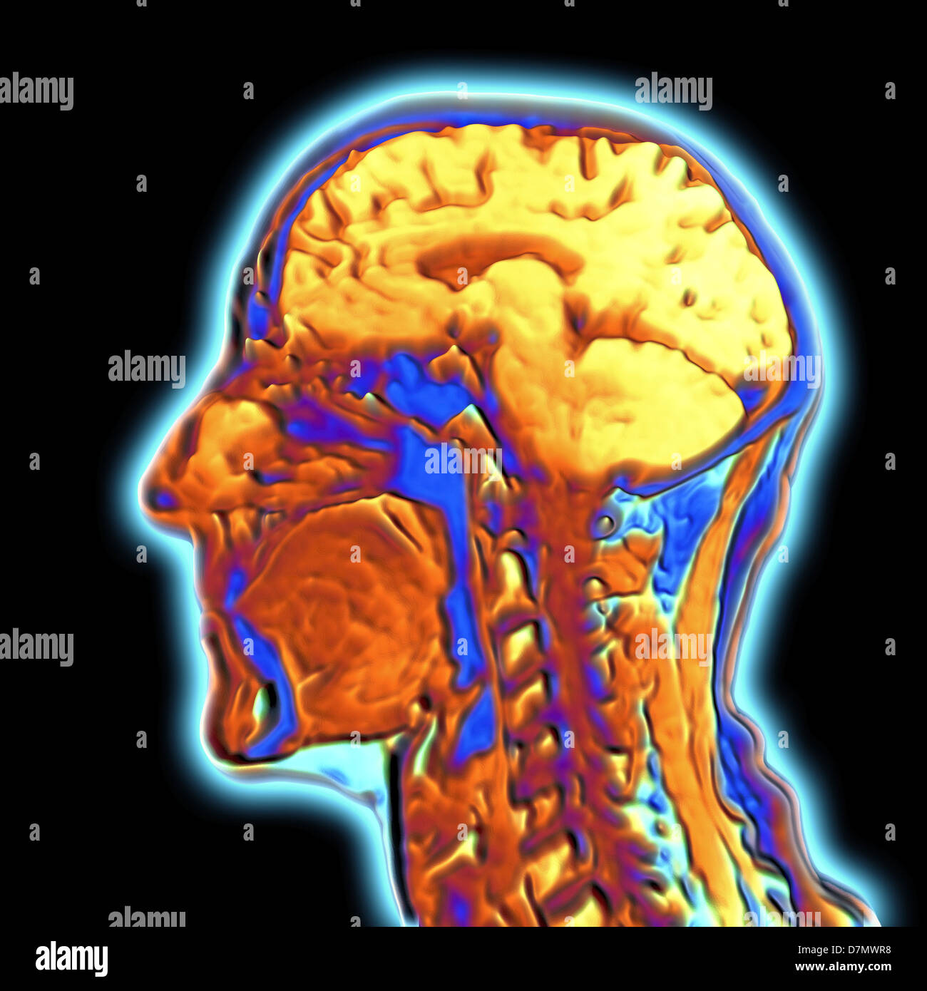 Mri von -Fotos und -Bildmaterial in hoher Auflösung – Alamy