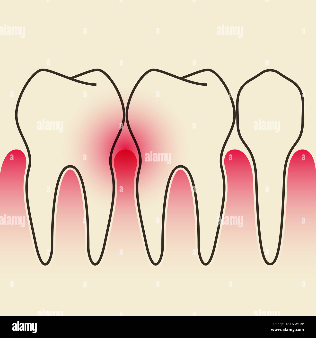Bakterien der parodontitis -Fotos und -Bildmaterial in hoher Auflösung ...