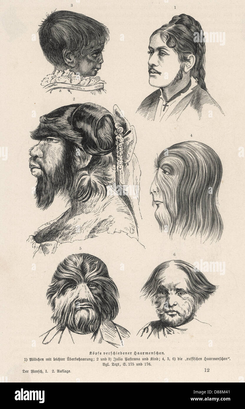 Behaarte frauen -Fotos und -Bildmaterial in hoher Auflösung – Alamy