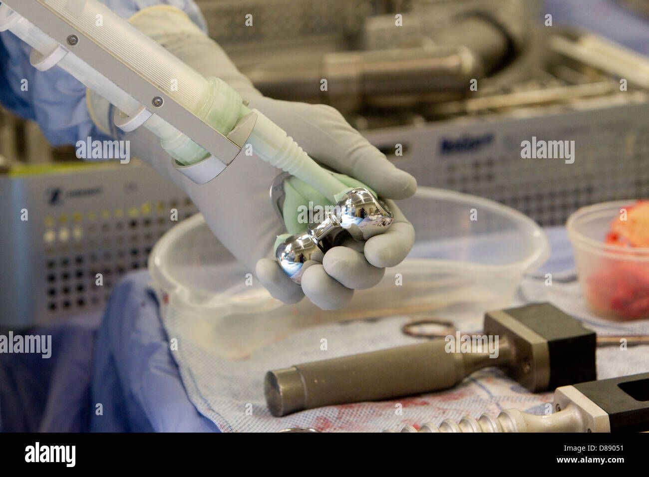 Total knee replacement operation in -Fotos und -Bildmaterial in hoher ...