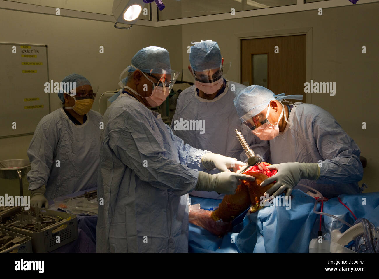 Total knee replacement operation in -Fotos und -Bildmaterial in hoher ...