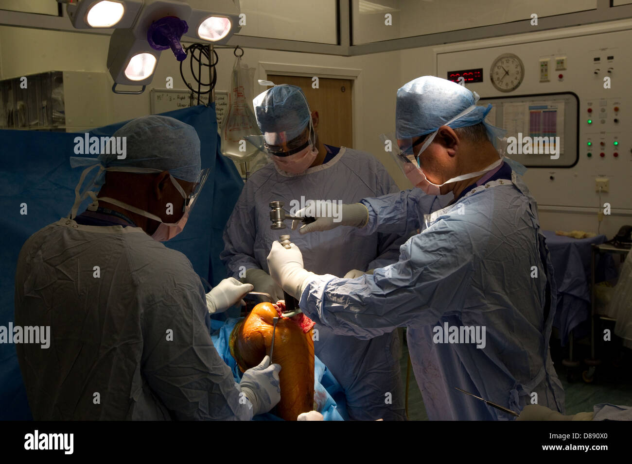 Knie-TEP Operation in einem Krankenhaus-Theater total Stockfotografie ...