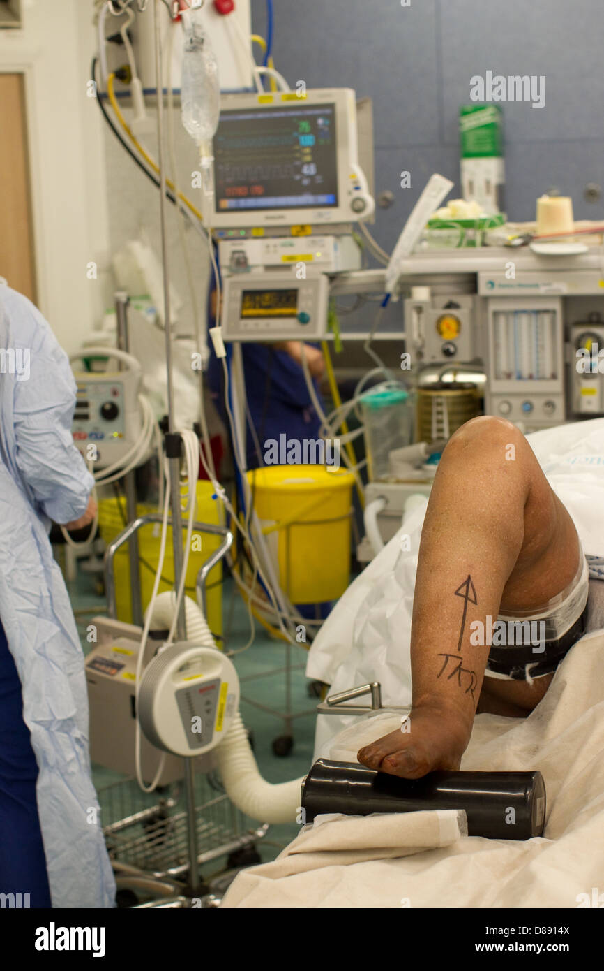 Knee operation -Fotos und -Bildmaterial in hoher Auflösung – Alamy