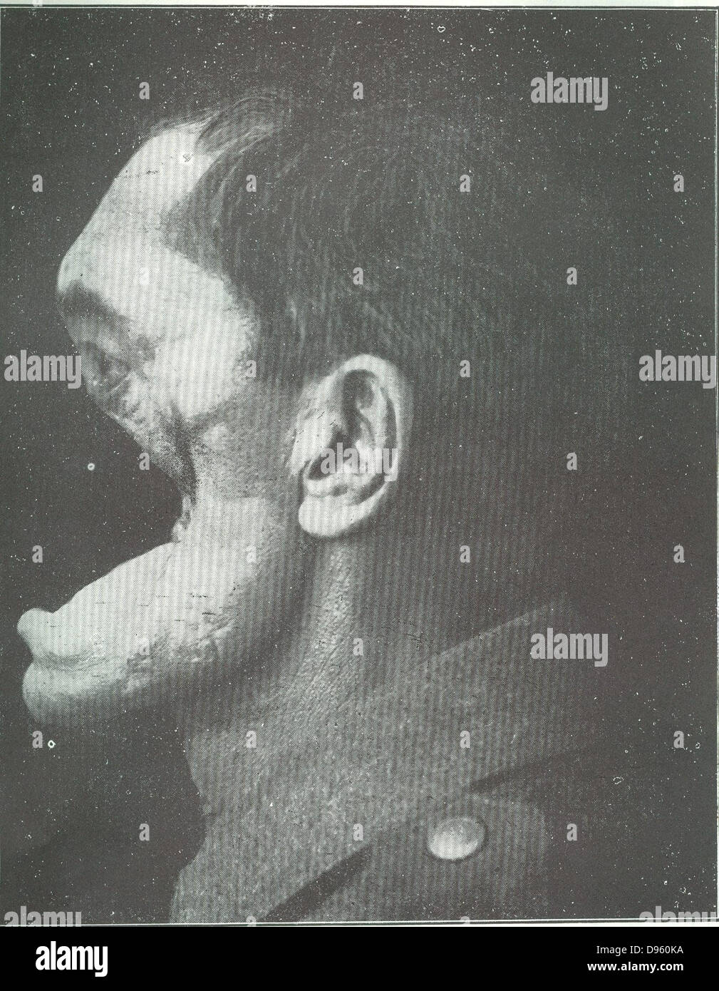 Schrecken des Krieges: Gesichtsverletzungen ins deutsche Soldat im ...