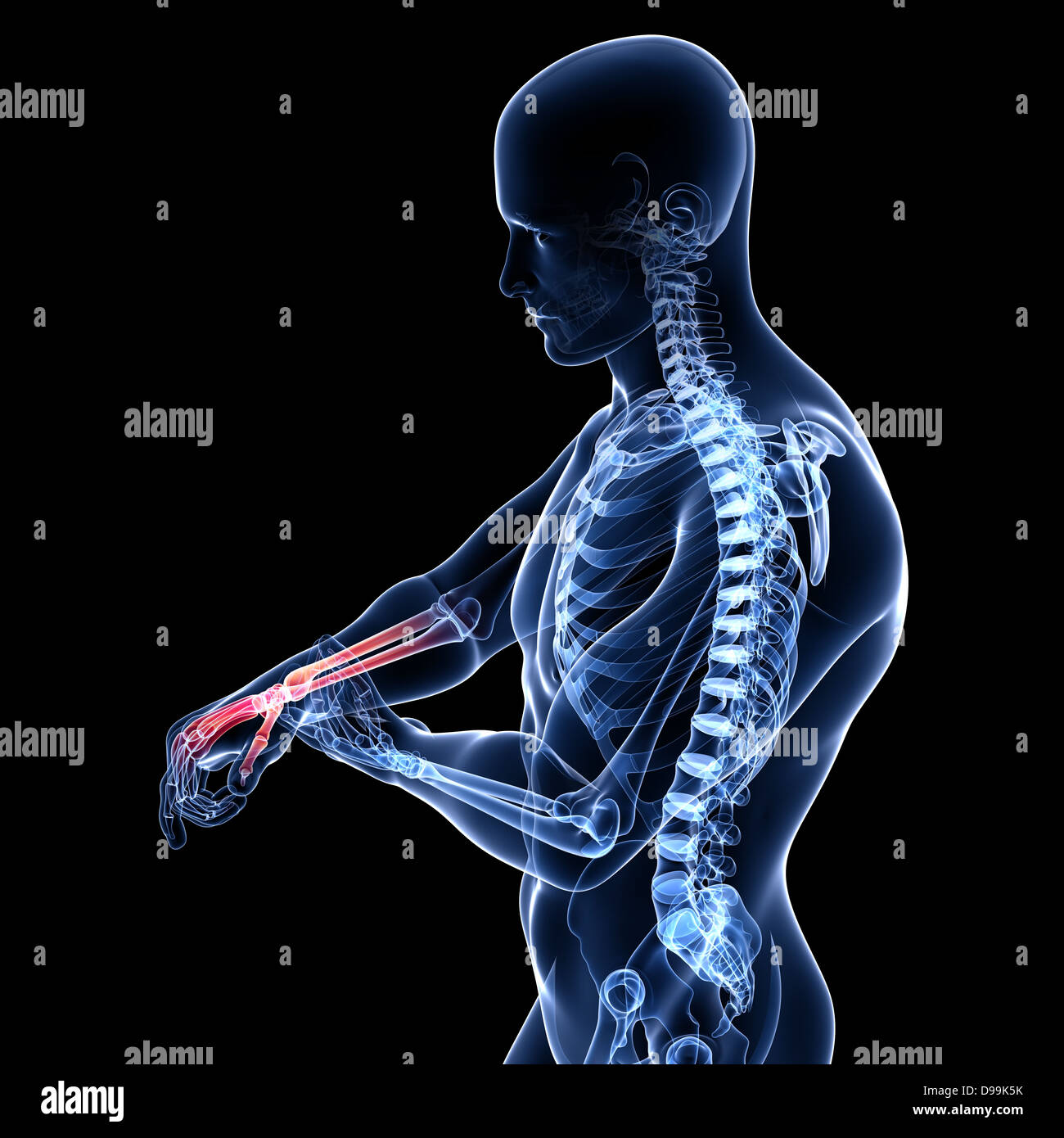 Anatomie des männlichen Hand Röntgen Stockfotografie - Alamy