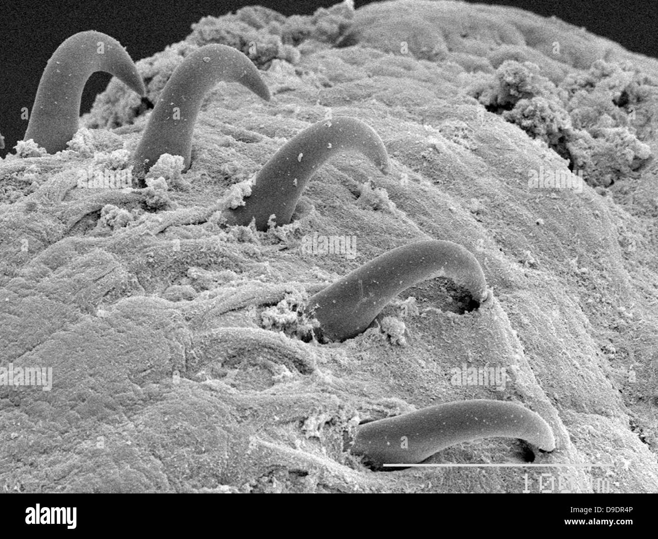 Cestoda tapeworm -Fotos und -Bildmaterial in hoher Auflösung – Alamy