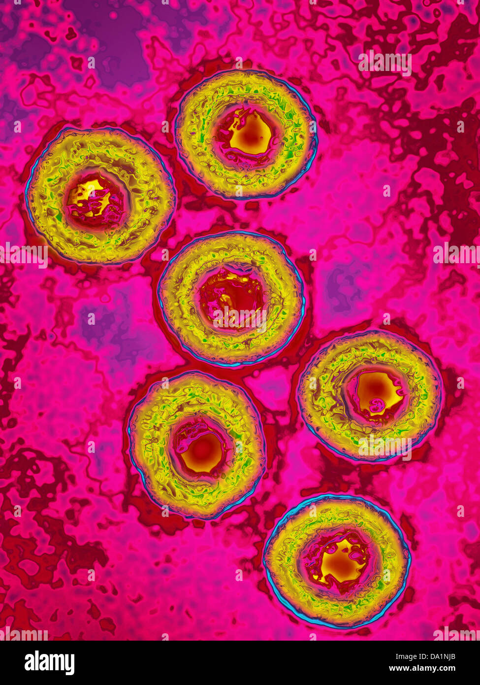 Herpes simplex viren -Fotos und -Bildmaterial in hoher Auflösung – Alamy