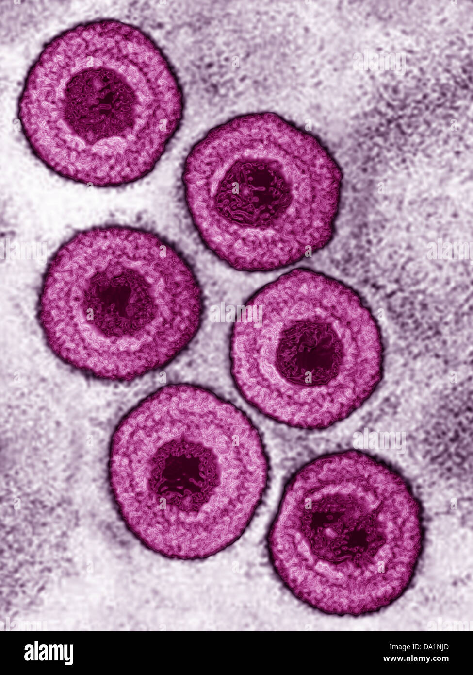 Varicella zoster virus -Fotos und -Bildmaterial in hoher Auflösung – Alamy