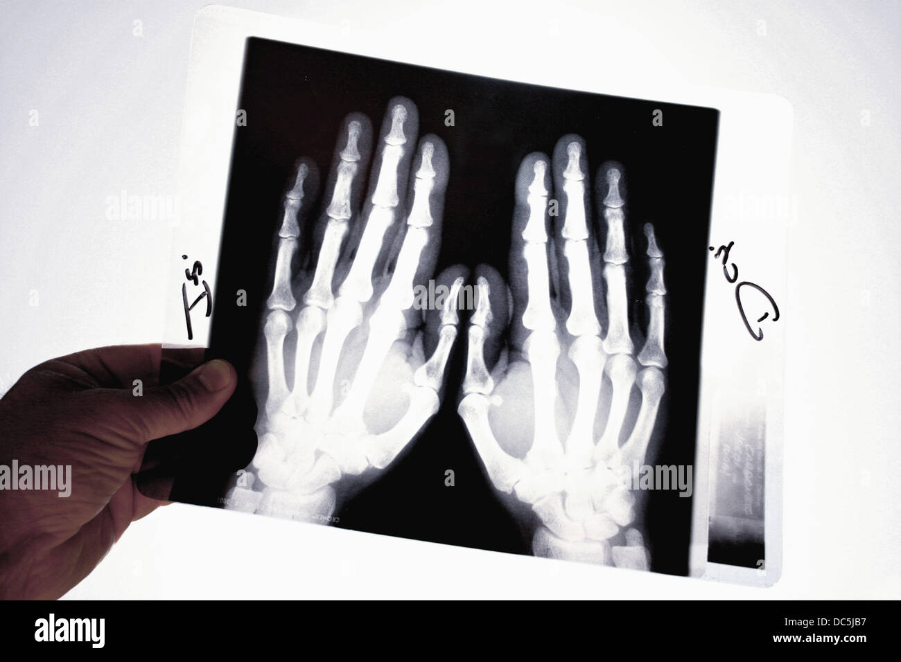 Gesundheit humanmedizin radiologie -Fotos und -Bildmaterial in hoher ...