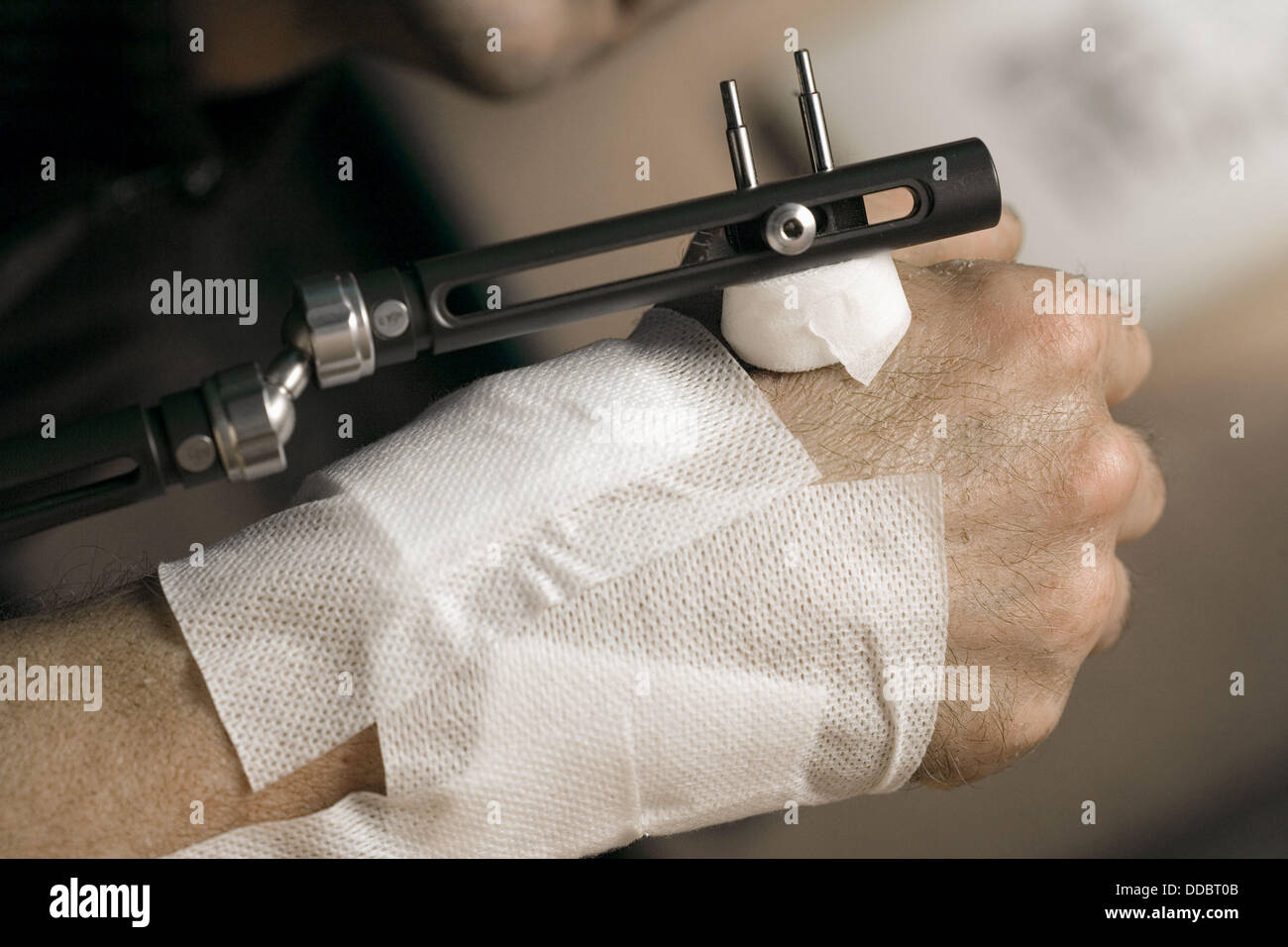 Fracture Blood Stockfotos und -bilder Kaufen - Alamy