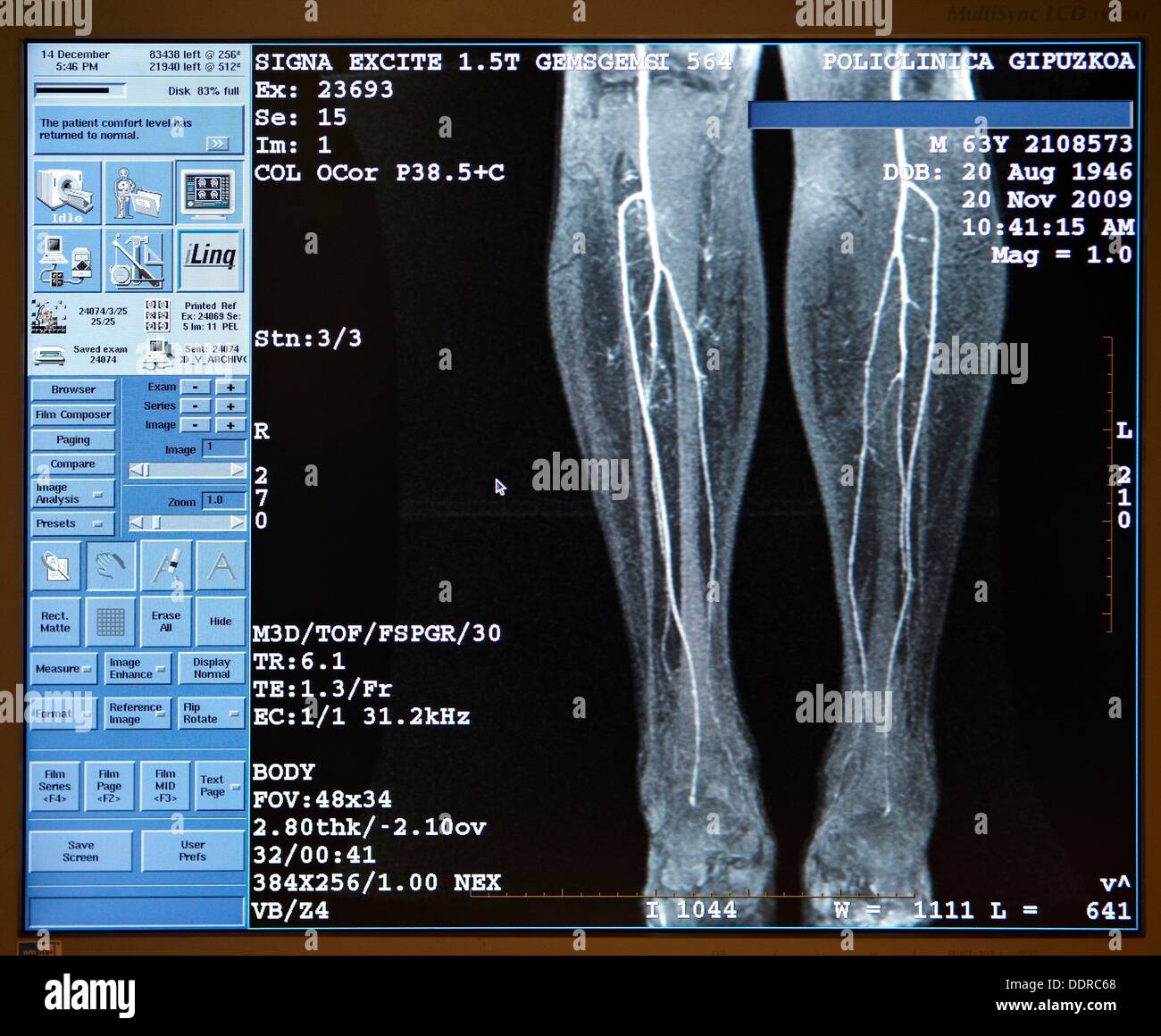 Beinarterien anatomie -Fotos und -Bildmaterial in hoher Auflösung – Alamy
