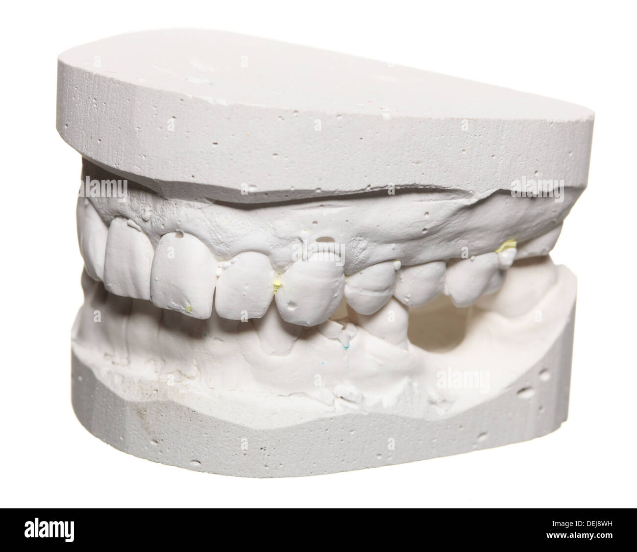 Dental Gießen Gips modellieren Gips Stomatologie-menschliche Kiefer ...