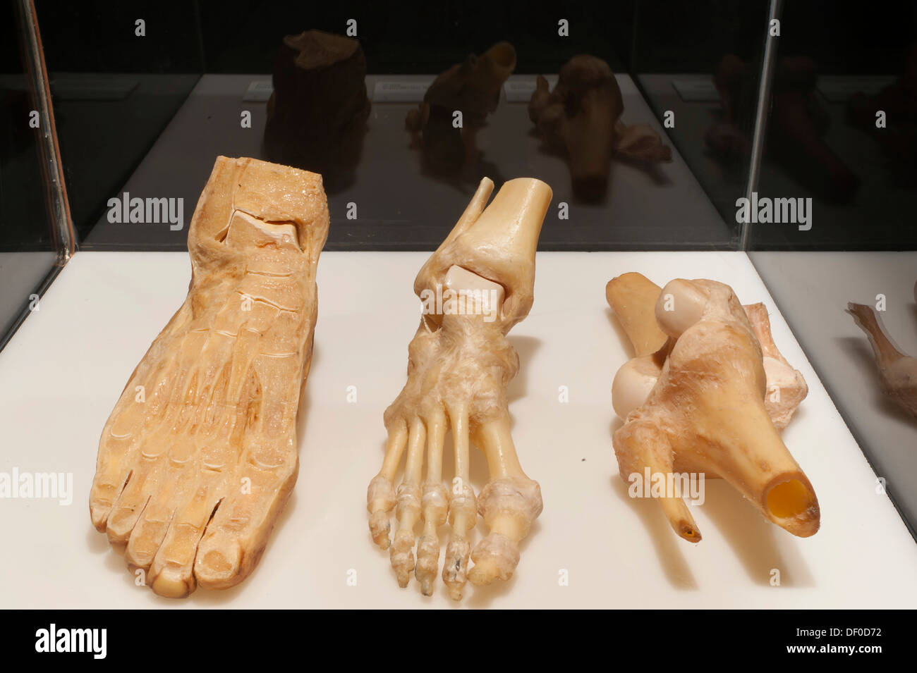 Plastination Exemplar des menschlichen Fußes mit und ohne Haut und ein ...