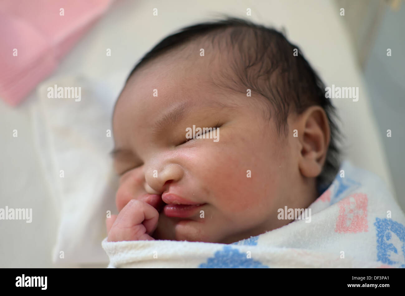 Lippenspalte chirurgie -Fotos und -Bildmaterial in hoher Auflösung – Alamy