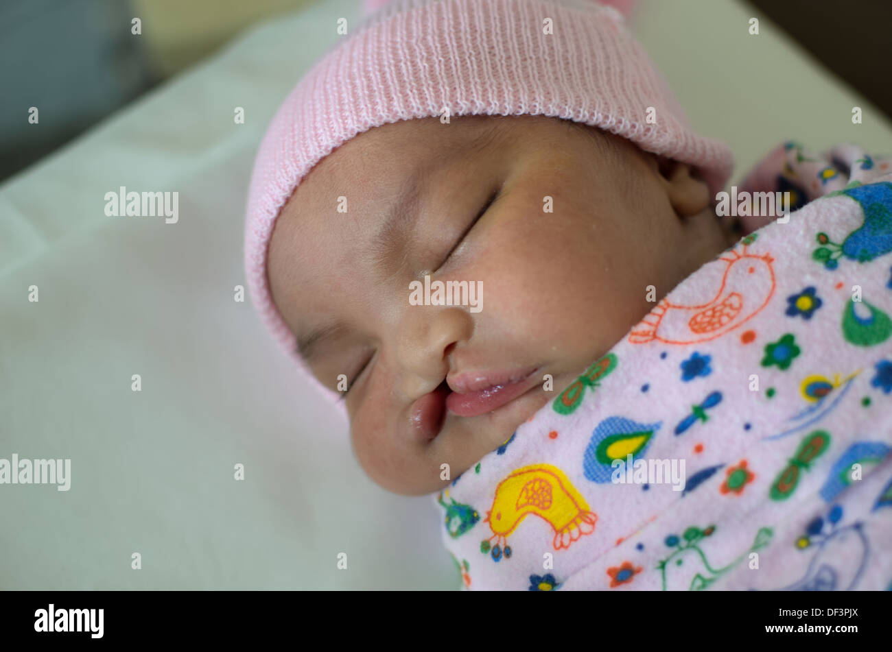 Lippenspalte chirurgie -Fotos und -Bildmaterial in hoher Auflösung – Alamy