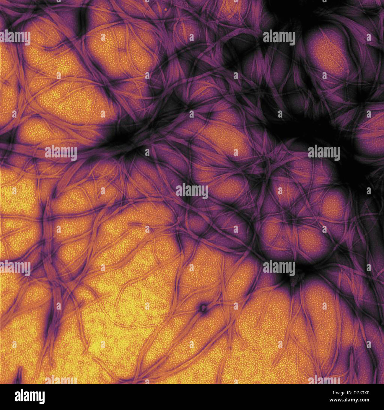 Prion disease -Fotos und -Bildmaterial in hoher Auflösung – Alamy