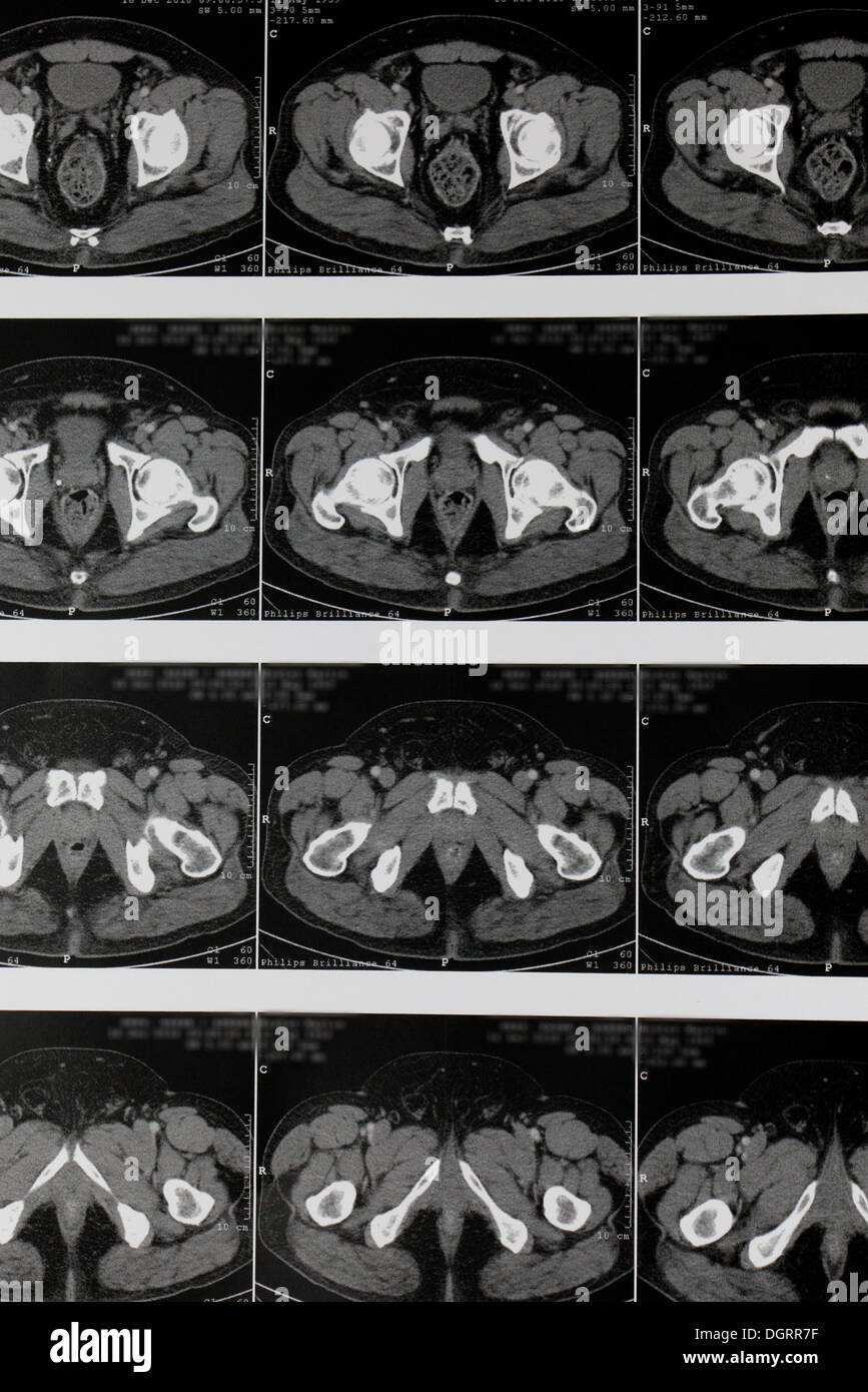 Diagnostic imaging technique -Fotos und -Bildmaterial in hoher ...