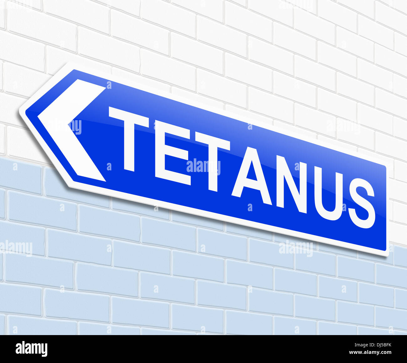 Tetanus lockjaw -Fotos und -Bildmaterial in hoher Auflösung – Alamy