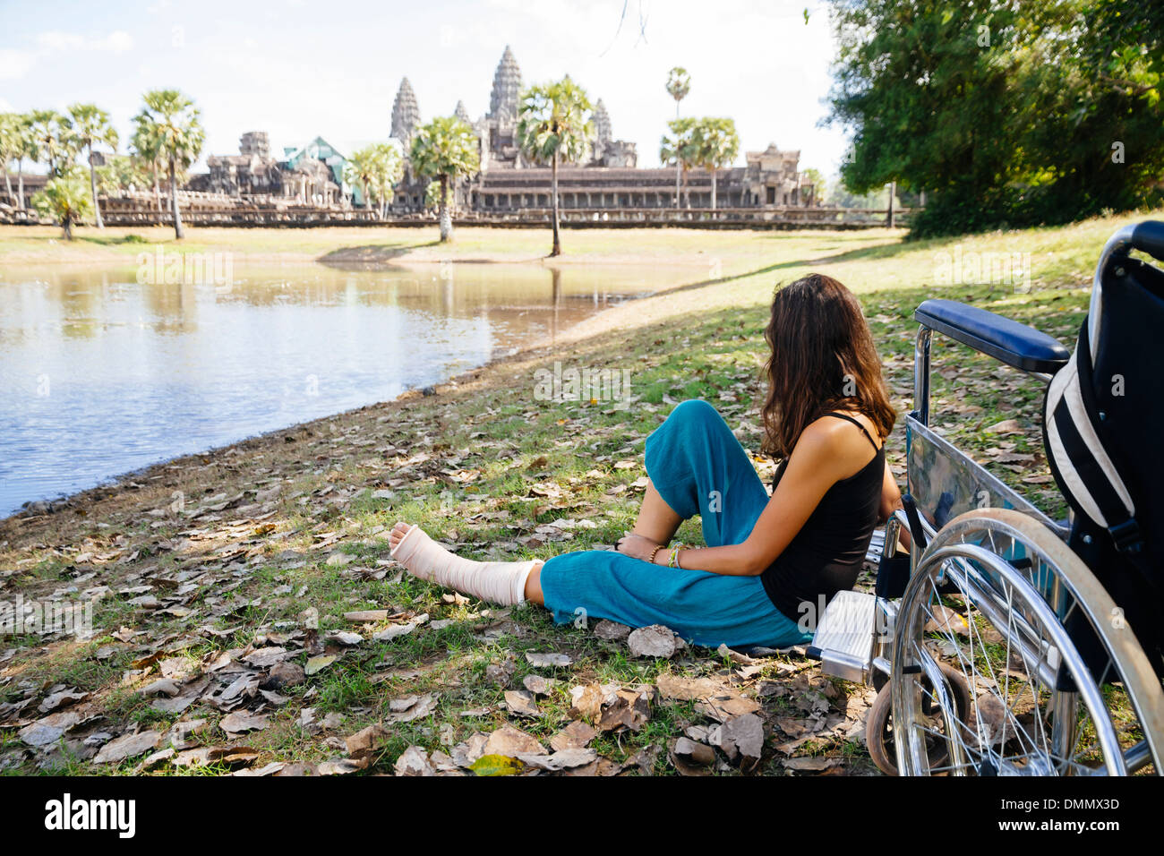Gebrochenes Bein Stockfotos und -bilder Kaufen - Alamy