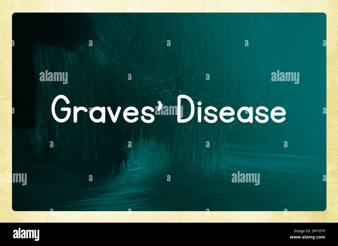 Larynx drawing -Fotos und -Bildmaterial in hoher Auflösung - Seite 7 ...