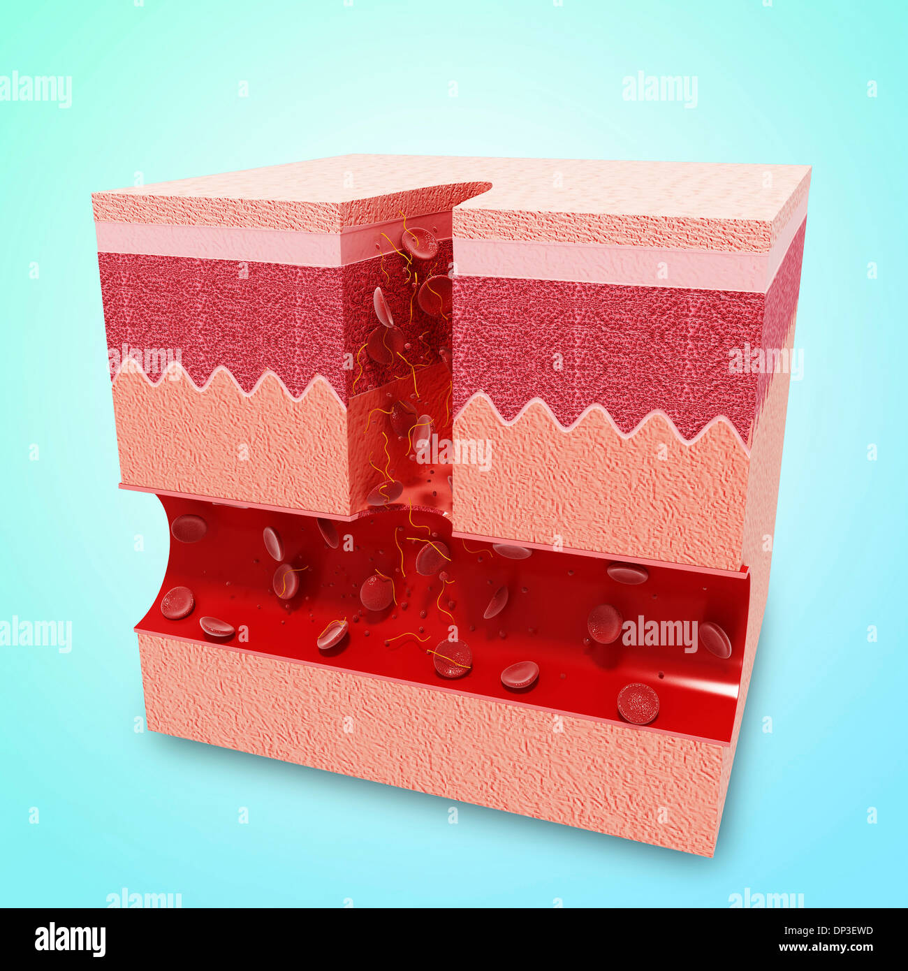 Anatomie der menschlichen Haut, artwork Stockfotografie - Alamy