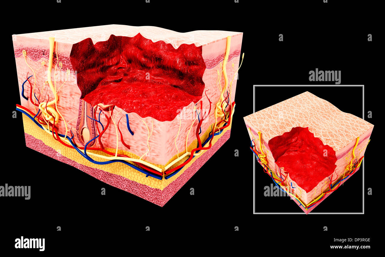 Anatomie der menschlichen Haut, artwork Stockfotografie - Alamy