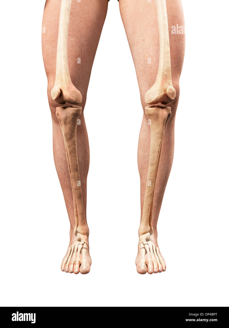 Genu varum -Fotos und -Bildmaterial in hoher Auflösung – Alamy
