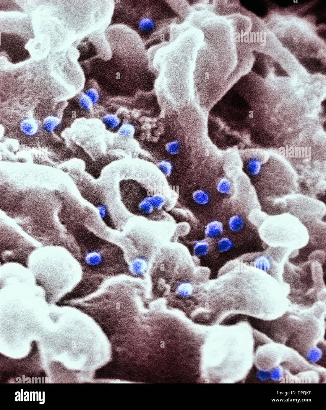 Hiv virus sem -Fotos und -Bildmaterial in hoher Auflösung – Alamy