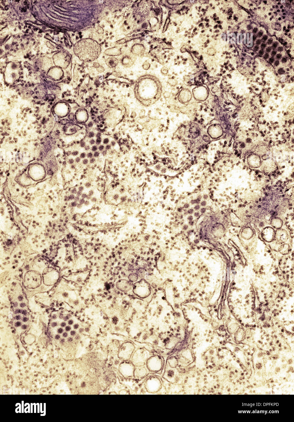 Louis enzephalitis -Fotos und -Bildmaterial in hoher Auflösung – Alamy