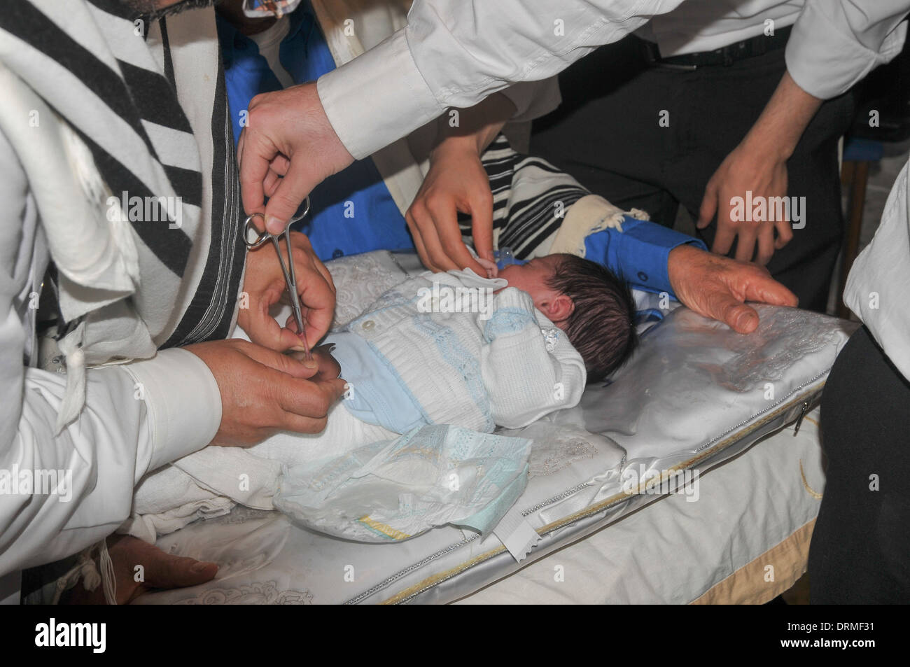 Operation circumcision -Fotos und -Bildmaterial in hoher Auflösung – Alamy