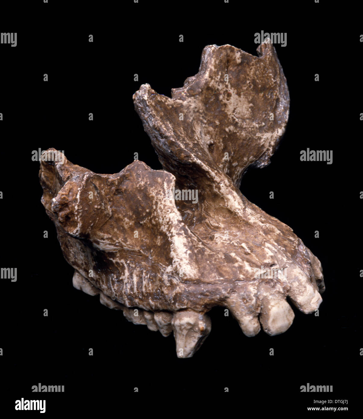 Zahnscherbe -Fotos und -Bildmaterial in hoher Auflösung – Alamy