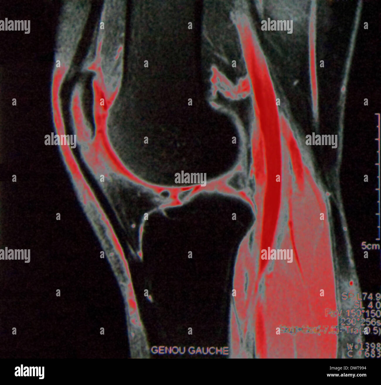 Mri nmr bildgebung -Fotos und -Bildmaterial in hoher Auflösung - Seite ...