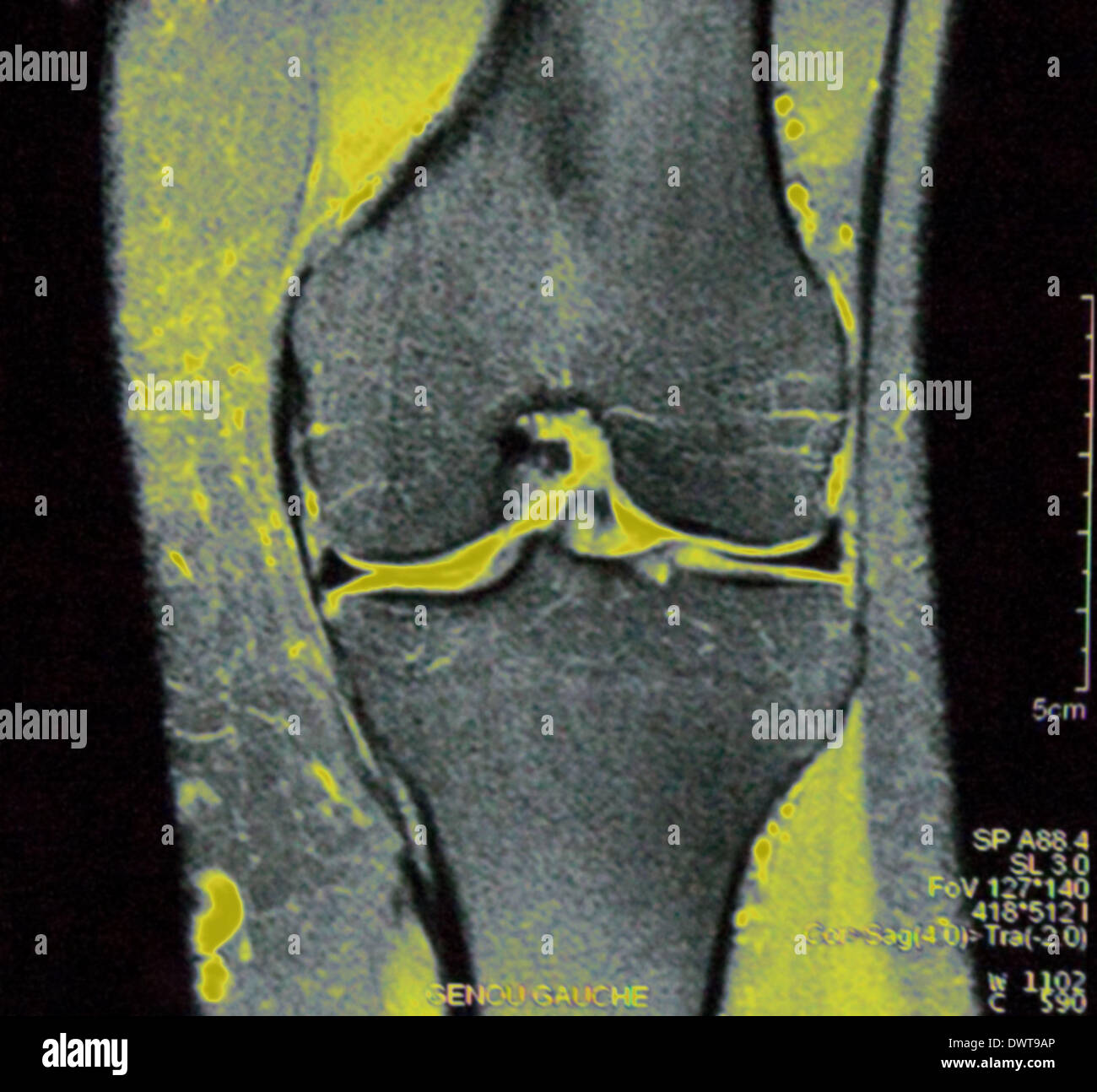 Osteomuskuläres System Stockfotos und -bilder Kaufen - Alamy