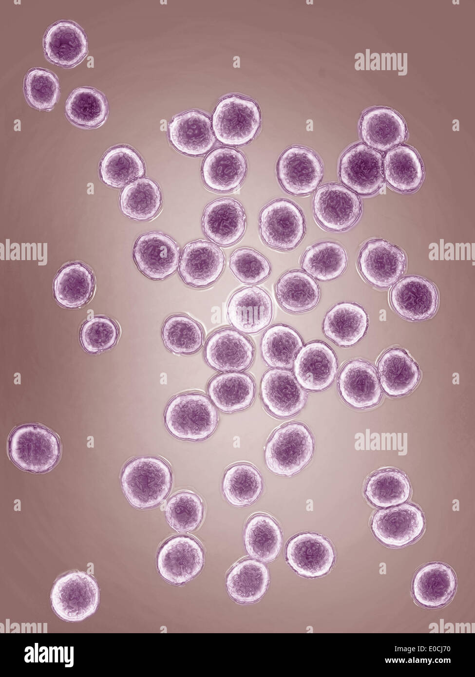 Staphylococcus saprophyticus -Fotos und -Bildmaterial in hoher ...