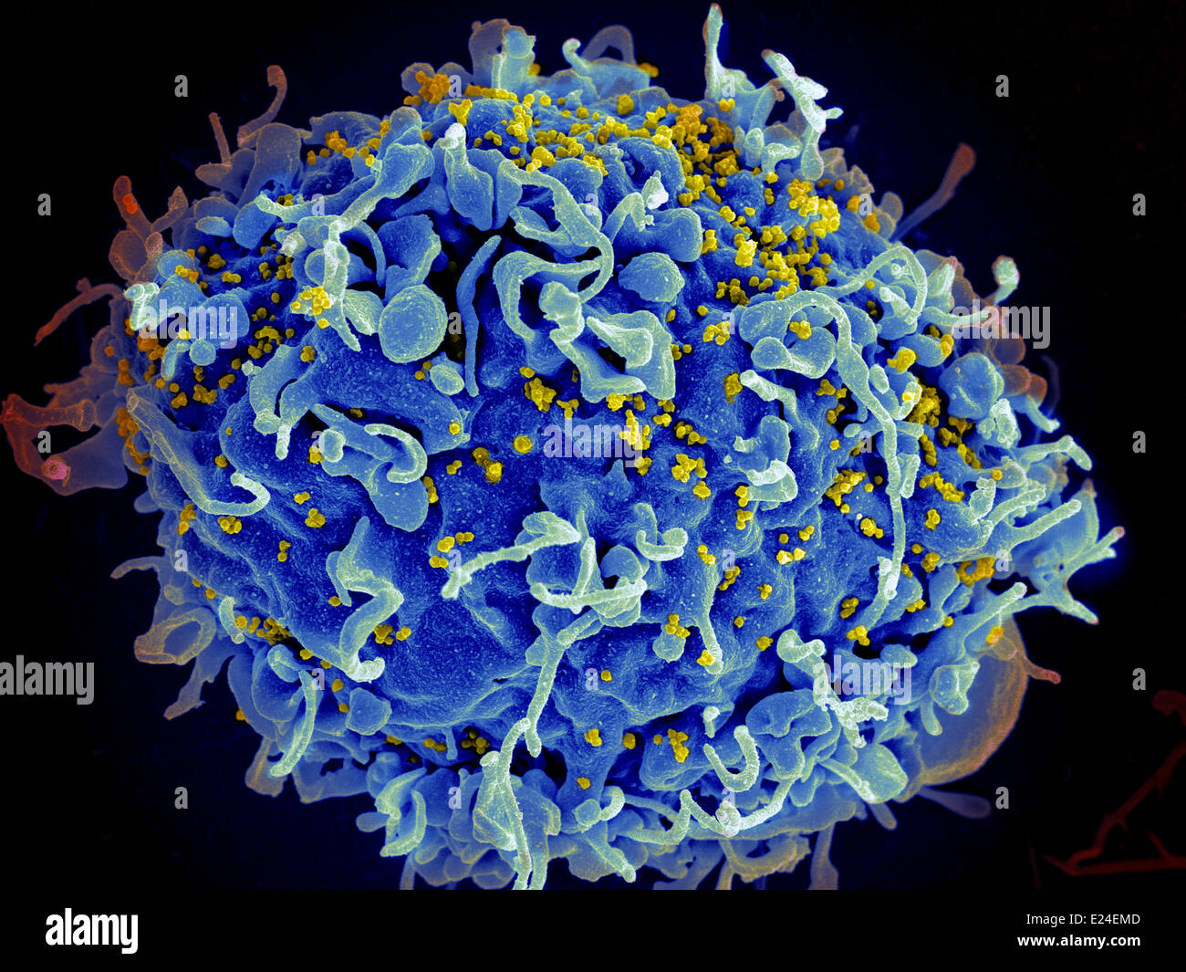 Hiv infizierte t zelle -Fotos und -Bildmaterial in hoher Auflösung – Alamy