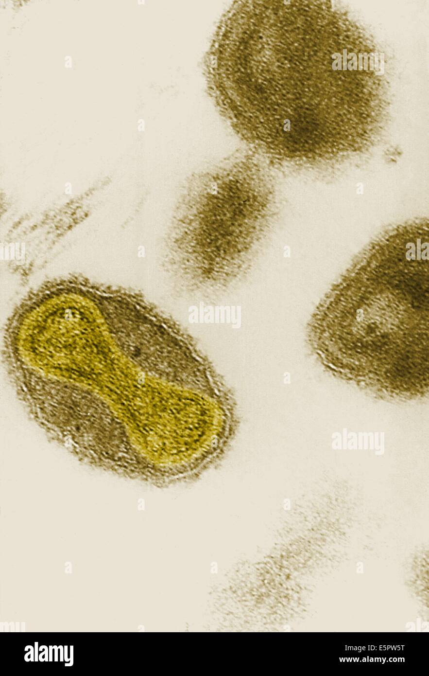 Transmission Electron Schliffbild (TEM) Variola Viren, Vergrößerung 370 ...