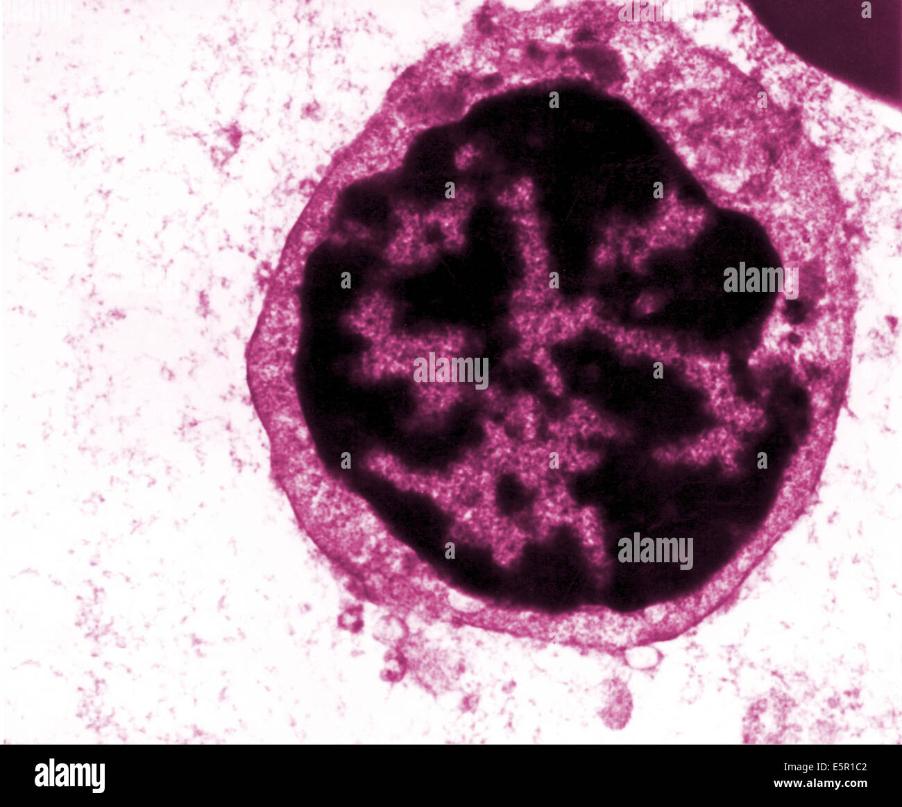 White blood cell electron micrograph -Fotos und -Bildmaterial in hoher ...