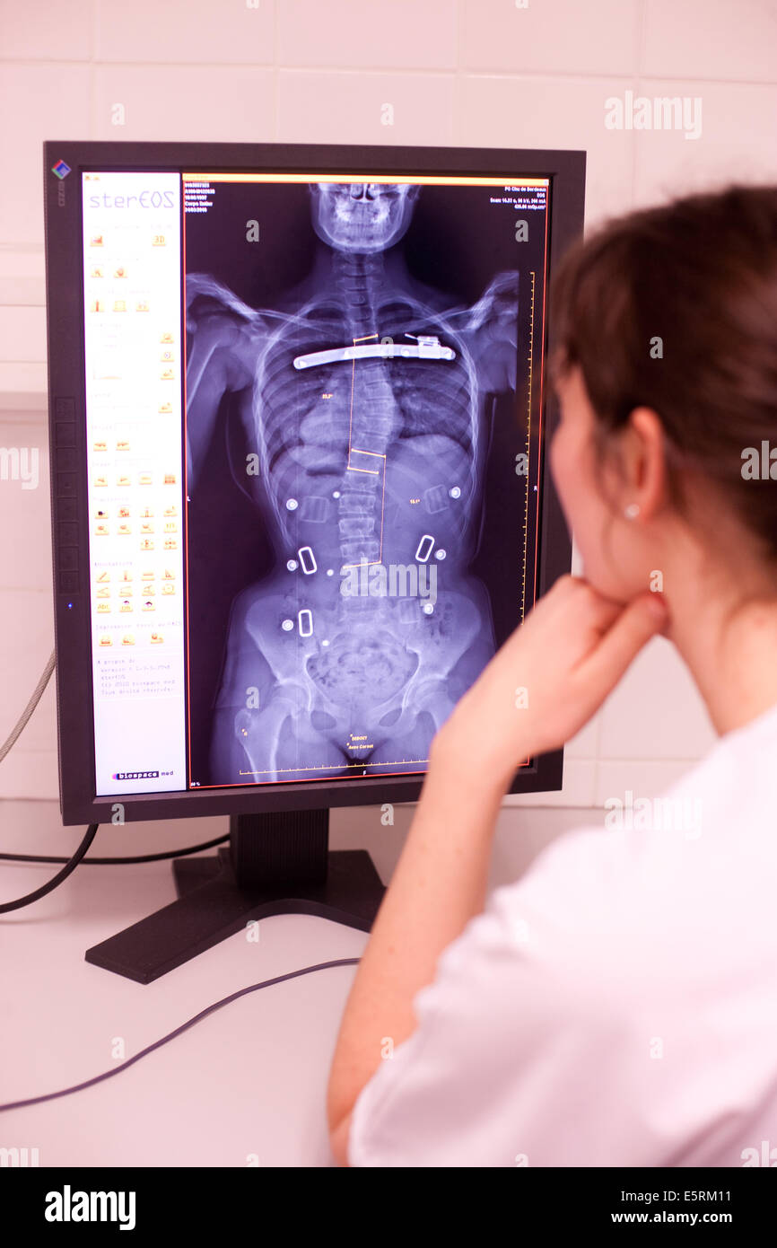 Skoliose korsett -Fotos und -Bildmaterial in hoher Auflösung – Alamy