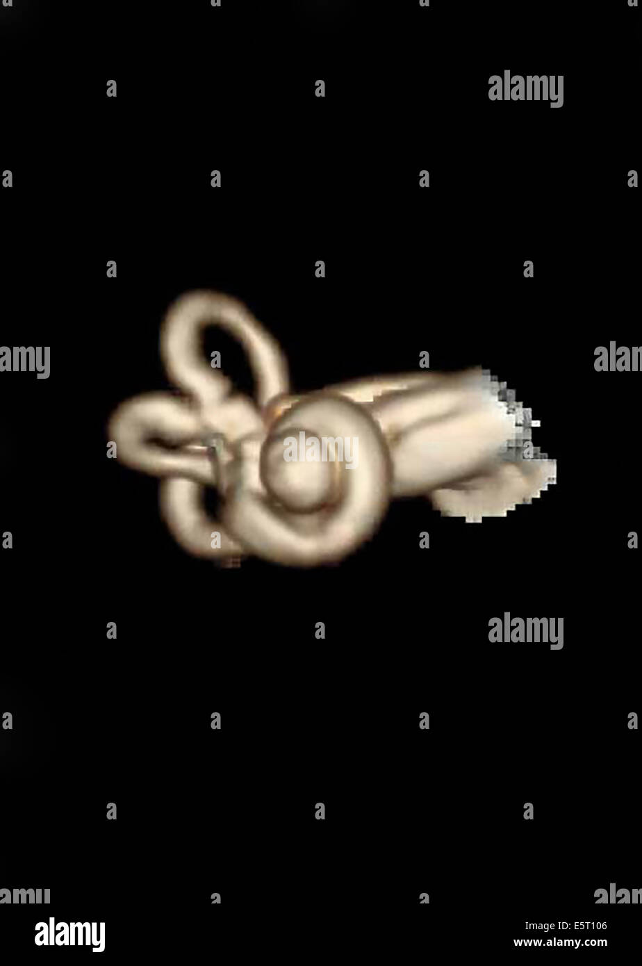 Membranous Labyrinth Stockfotos und -bilder Kaufen - Alamy