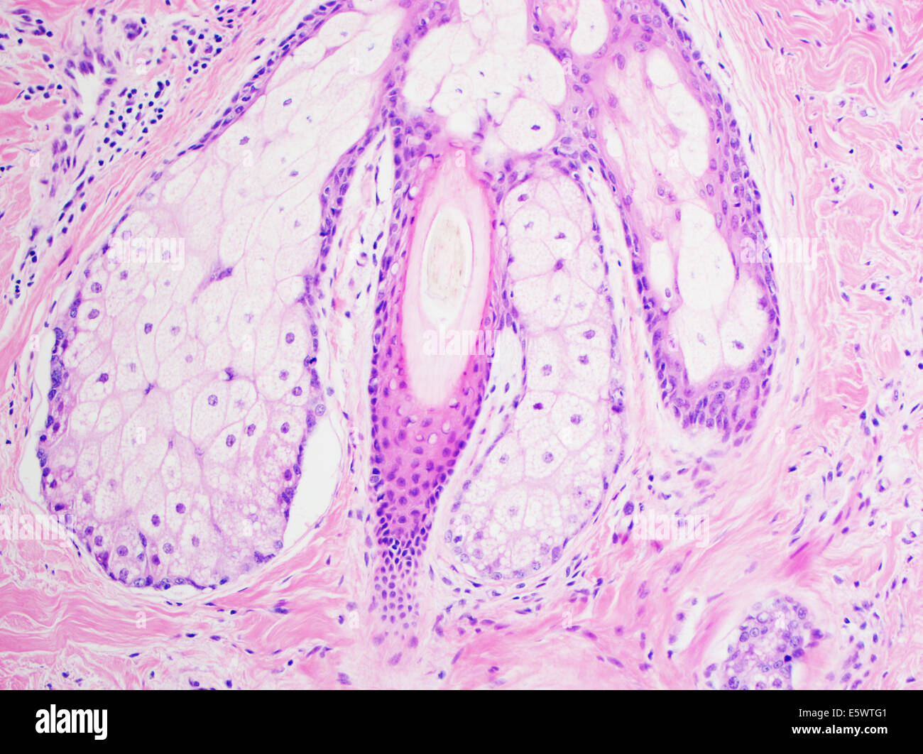 Hematoxylin and eosin stain -Fotos und -Bildmaterial in hoher Auflösung – Alamy
